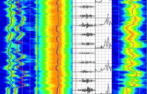 Cross Dipole Sonic - Wireline Logging Solutions